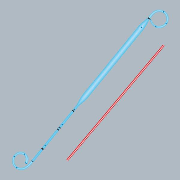 Endopyelotomy Stent – Allwin Medical devices