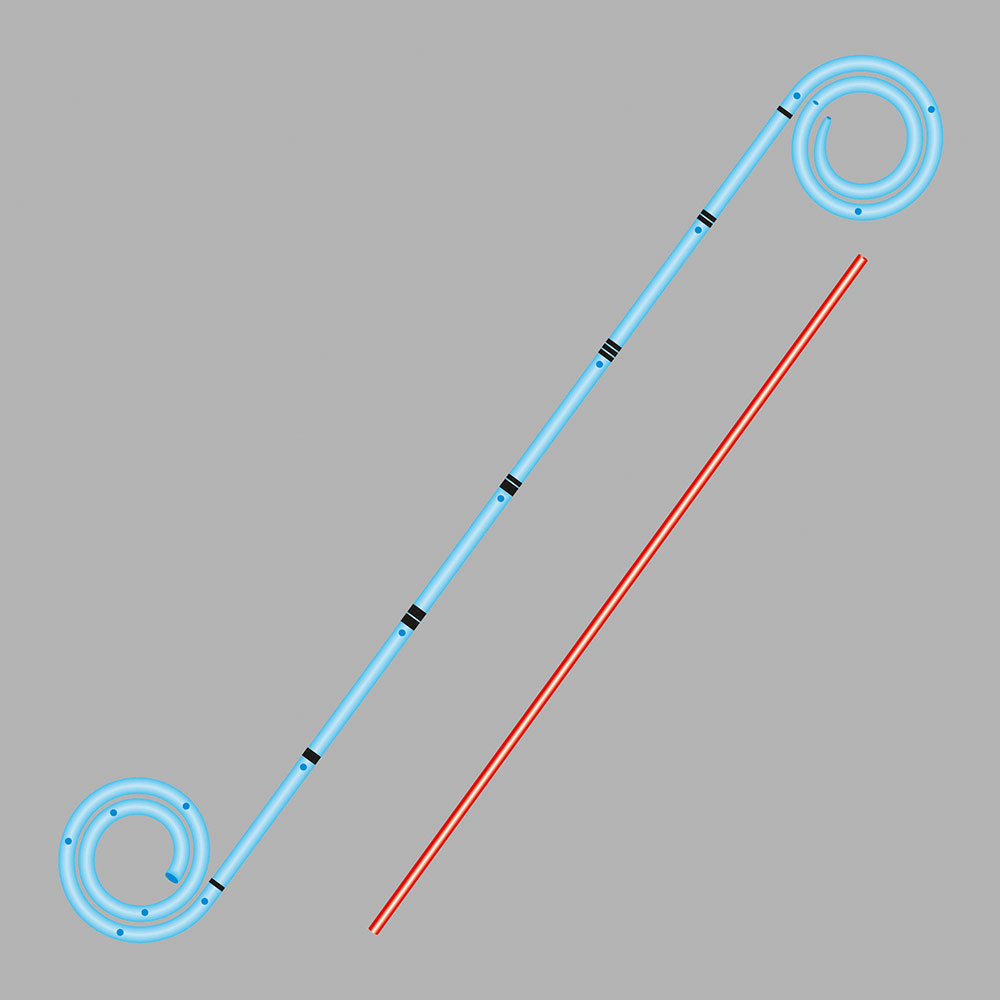 allSoftMultiloop Ureteral Stents(Open Tip & Closed Tip) – Allwin Medical